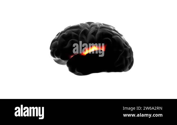 Human brain damage, red inflammatory process on an isolated white ...