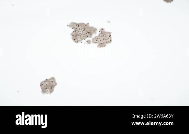 Bacteria Under The Microscope. An animated clip of a large colony Stock ...
