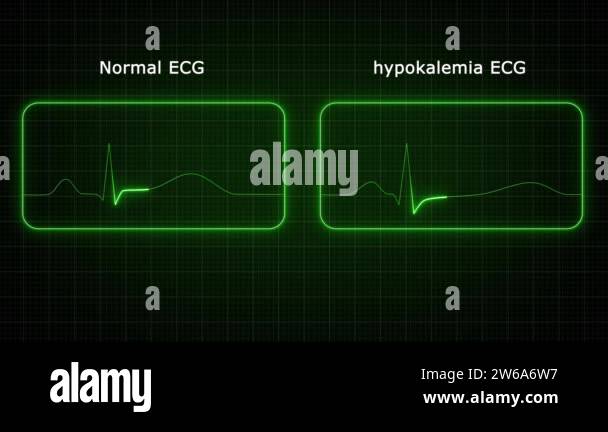 Green light glowing lifeline animation. Electric neon lighting follow ...