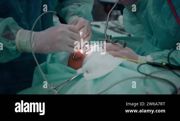 The doctor performs a pediatric surgical operation to remove the ...