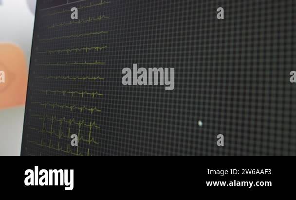 Heart rate monitor in hospital theater. Medical vital signs monitor ...