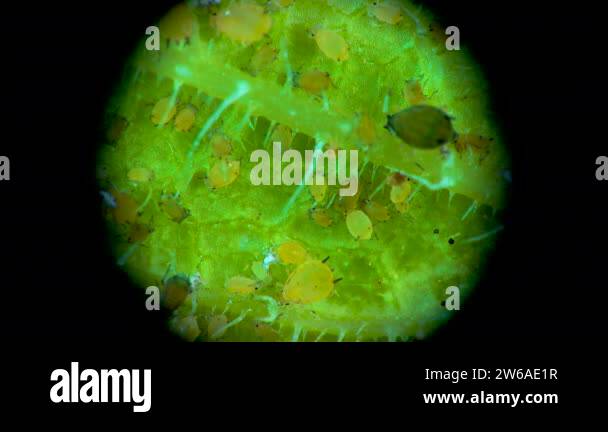 Aphid under a microscope, - aphid superfamily (Aphidoidea, Hemiptera ...