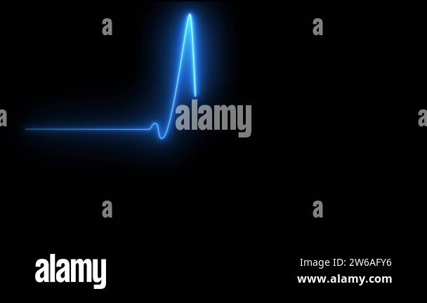 EKG Heartbeat Display Monitor - Motion Graphics, seamless loop ...