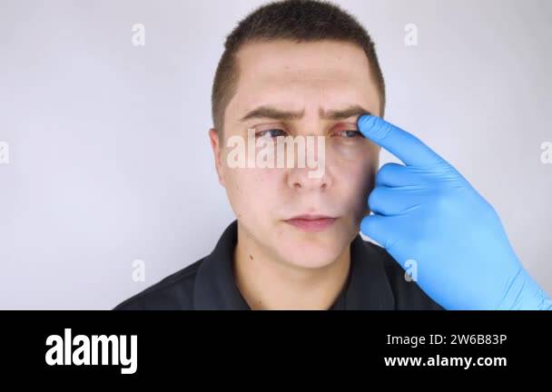 A doctor examines a patient who has blepharitis. Treatment of ...