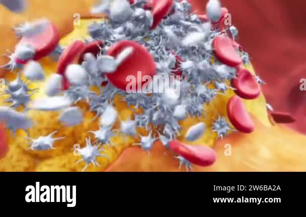Depiction of a blood clot forming inside a blood vessel. 3D animation ...