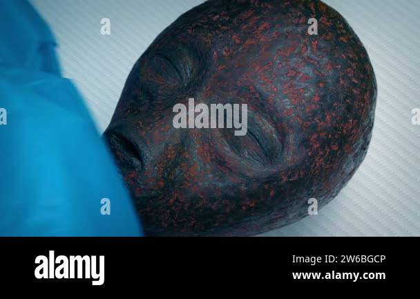 Corpse table sheet Stock Videos & Footage - HD and 4K Video Clips - Alamy