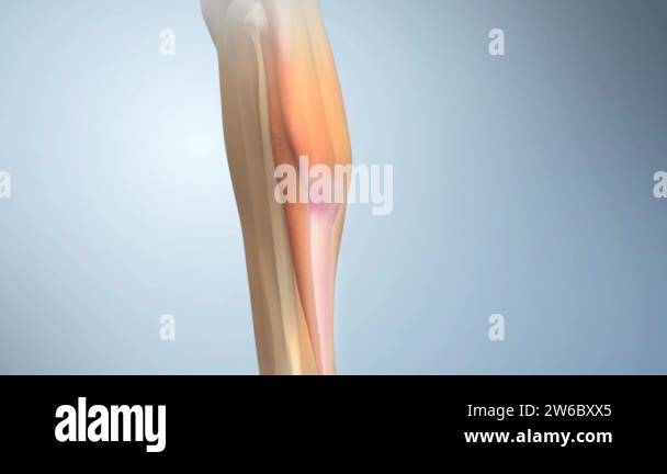 Tendon structure Stock Videos & Footage - HD and 4K Video Clips - Alamy