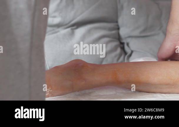 Wearing plaster Stock Videos & Footage - HD and 4K Video Clips - Alamy