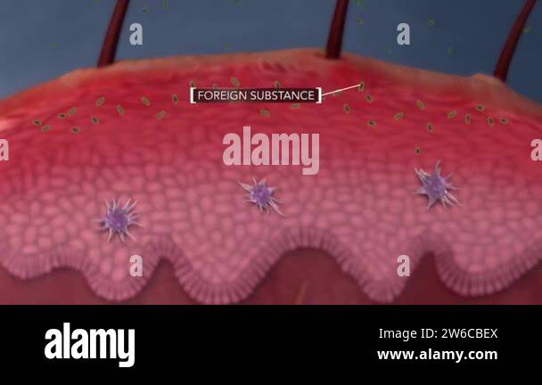The attack of airborne bacteria on the skin wound and the activation of ...