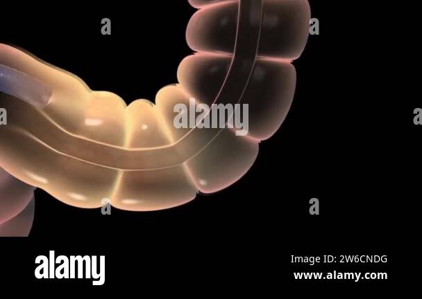 Colon digestive system Stock Videos & Footage - HD and 4K Video Clips ...