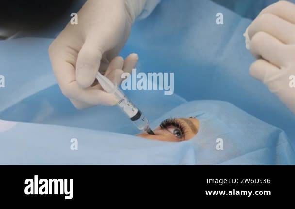 Surgery to correct strabismus. View through a microscope. The surgeon ...