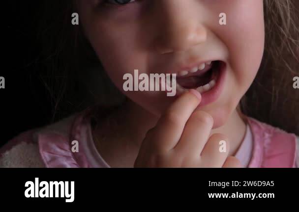 Cute preschooler child wobbling her lower milk tooth and smiling ...