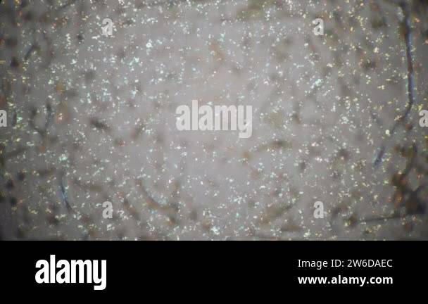 Amoebas and bacillus are moving in a drop of water filmed in scientific ...