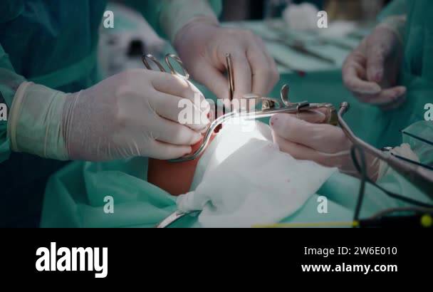 The doctor performs a pediatric surgical operation to remove the ...