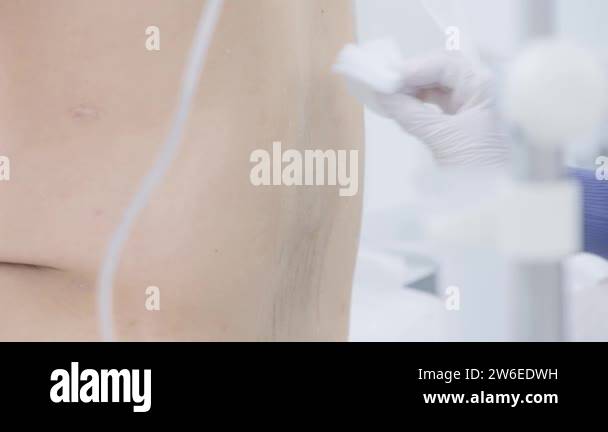 Nurse wiping injection site. Action. Nurse wipes injection site with ...