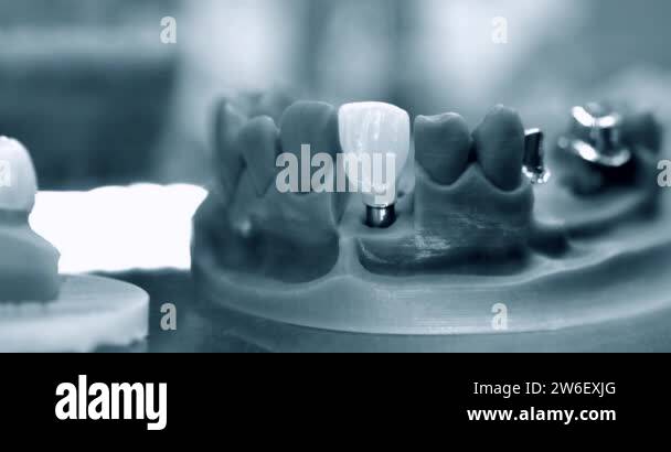 Collapsible jaw model teeth Stock Videos & Footage - HD and 4K Video ...