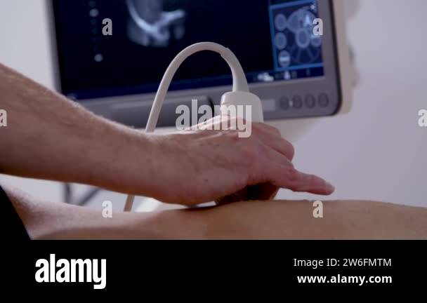 Patient on ultrasound scan Stock Videos & Footage - HD and 4K Video ...