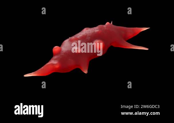 For Bone Tumours Stock Videos And Footage Hd And 4k Video Clips Alamy