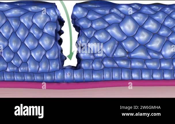 Human papillomavirus, a virus which causes warts, some strains infect ...
