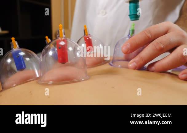 Chinese cupping glass Stock Videos & Footage - HD and 4K Video Clips ...