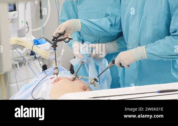 Healthcare concept. Surgeon with assistants makes laparoscopic surgical ...