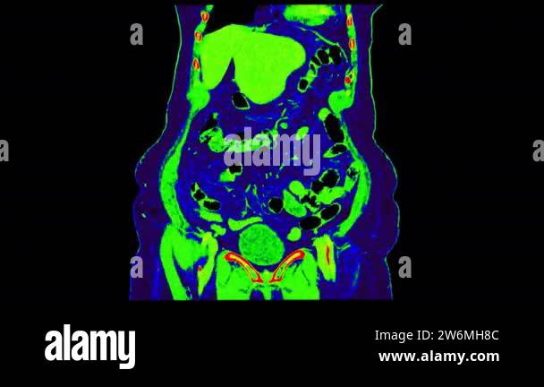 Positron tomography Stock Videos & Footage - HD and 4K Video Clips - Alamy