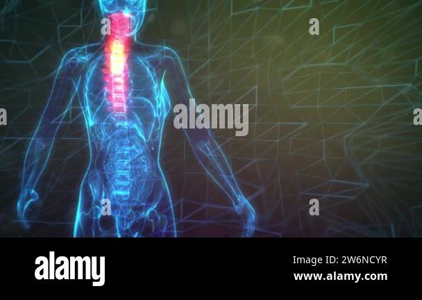 Cervical, top part of human spine on x-ray scan of body Stock Video ...
