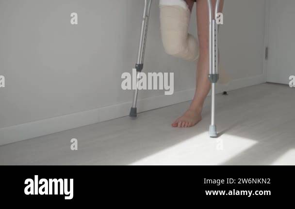Woman leg cast crutches in Stock Videos & Footage - HD and 4K Video ...