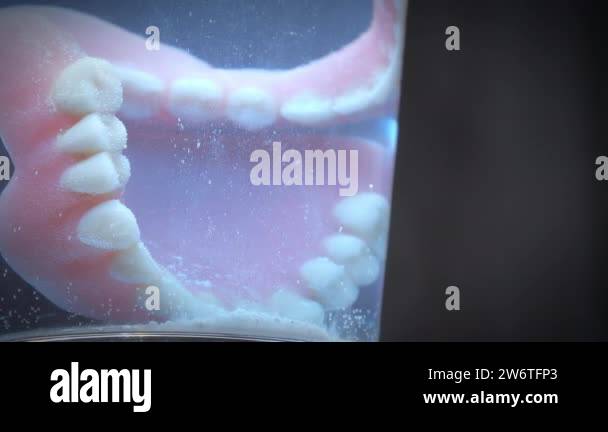 Full teeth Stock Videos & Footage - HD and 4K Video Clips - Alamy