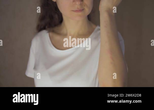 Woman suffering from itching on her skin and scratching an itchy place ...