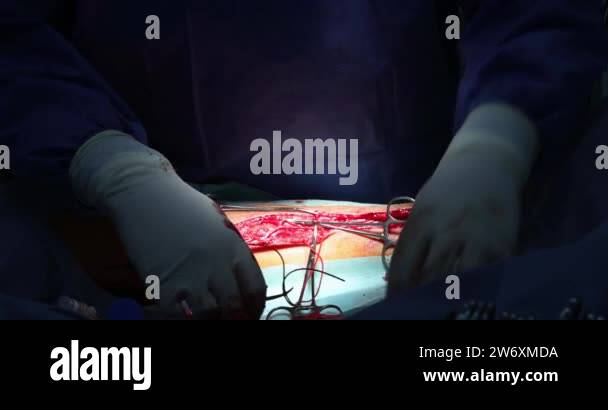 Cutting legs Stock Videos & Footage - HD and 4K Video Clips - Alamy