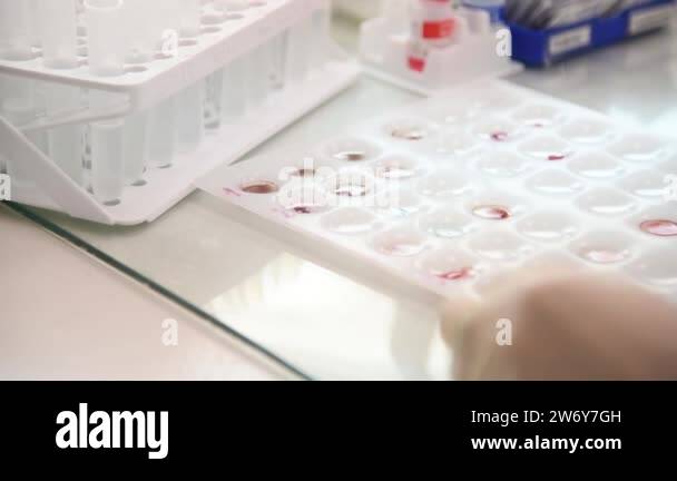 The medical laboratory at the blood center. The doctor works with blood ...