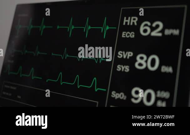 Looped: Patient monitor displays vital signs ECG electrocardiogram EKG ...