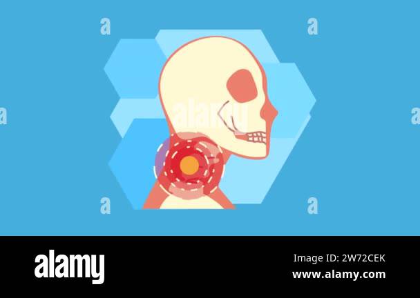 neck pain rheumatology disease animation Stock Video Footage - Alamy