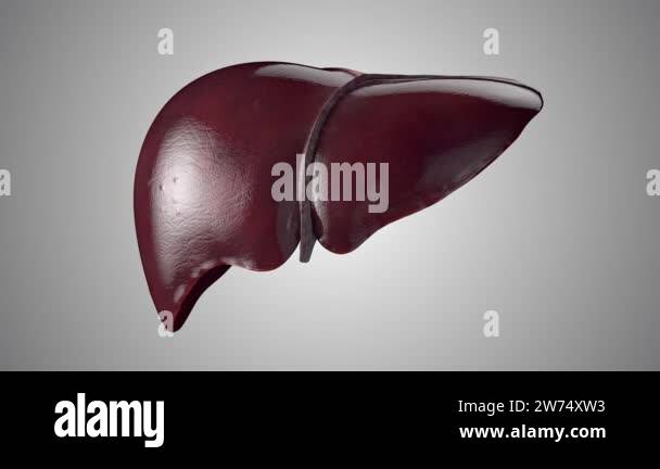 Realistic 3d animation of human liver sick stages from healthy to liver ...