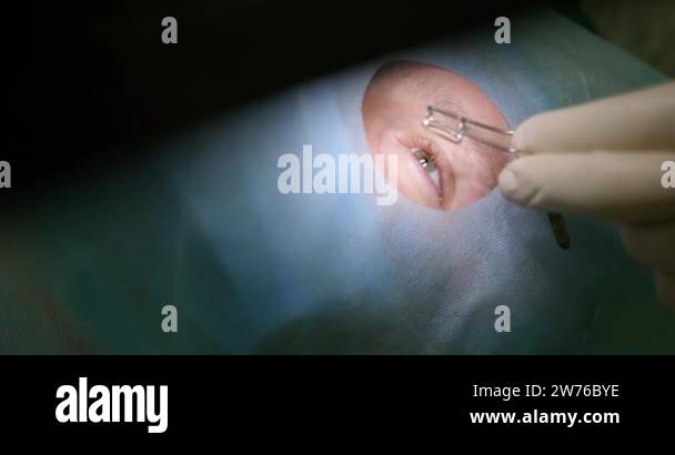 Preparation for ophthalmic surgery. The hand of surgeon holding Eye ...