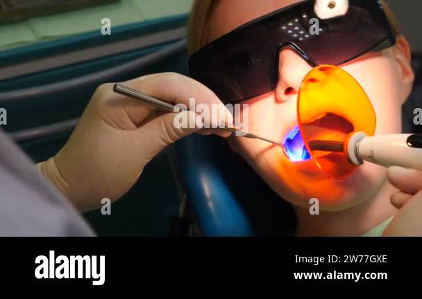 Dentist fixing light filling using photopolymer dental cordless lamp ...