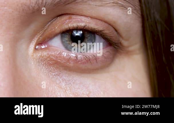 Pretty female with gray eye looking at camera and smiles, pupil with ...