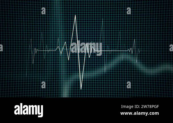 Ekg heart monitor Stock Videos & Footage - HD and 4K Video Clips - Alamy