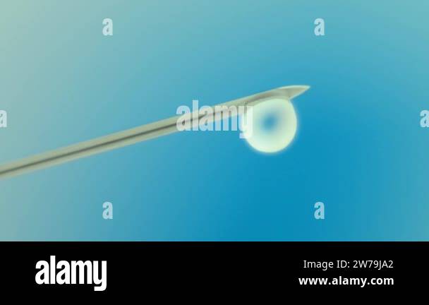 Sharp needle Stock Videos & Footage - HD and 4K Video Clips - Alamy