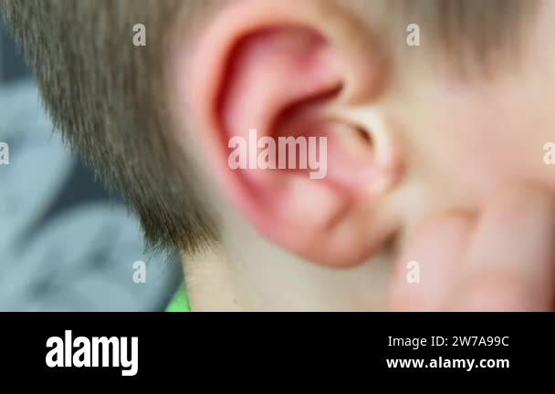 close-up part of the head of a child, kid, scratches his ear with his ...