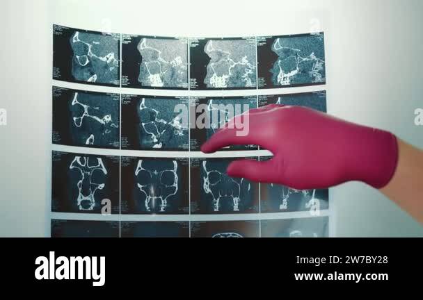 Computed tomography in the hands of a doctor close up. The CT scan ...