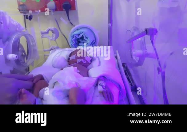 Uv light therapy for jaundice Stock Videos & Footage - HD and 4K Video ...