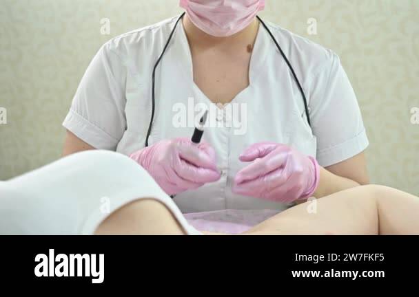 Doctor electrologist opens a sterile electrolysis needle Stock Video ...