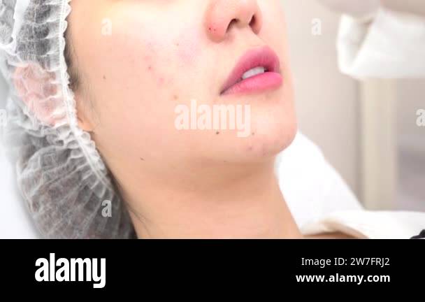 Asian woman getting cosmetic injection of botox in her cheeks. Botox ...