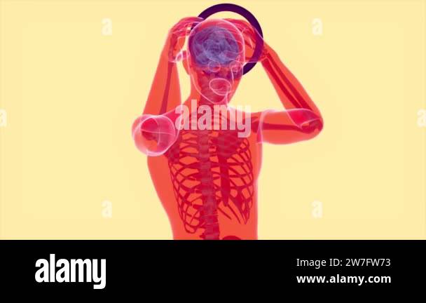 headache, Human and brain xray, human anatomy, 3D animation Stock Video ...
