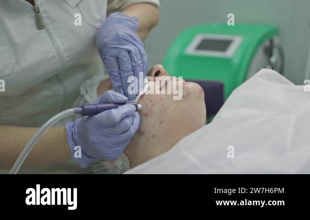 Procedure operation Stock Videos & Footage - HD and 4K Video Clips - Alamy