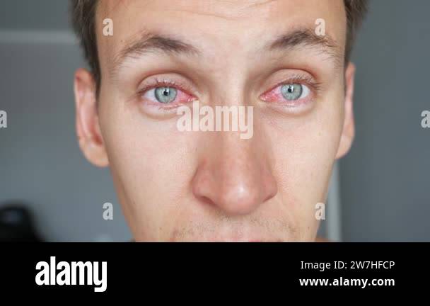 Man red eyes Stock Videos & Footage - HD and 4K Video Clips - Alamy