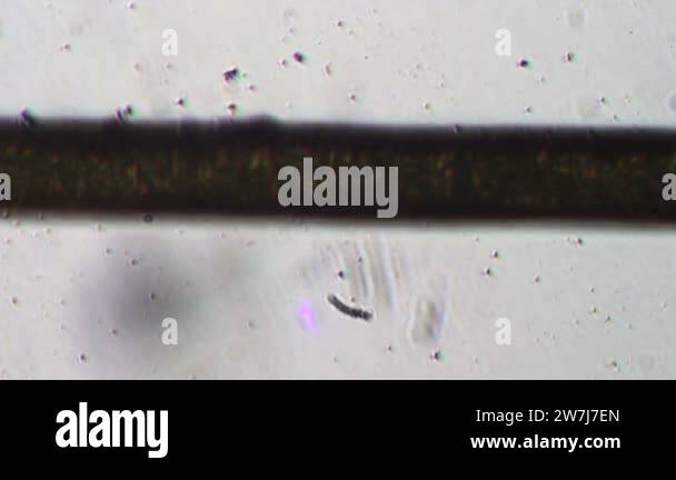Micrograph hair cell Stock Videos & Footage - HD and 4K Video Clips - Alamy