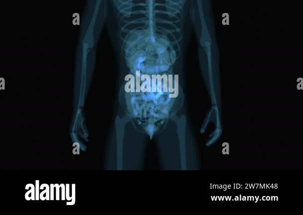 3D animation of Human Digestive System Large Intestine Anatomy Stock ...